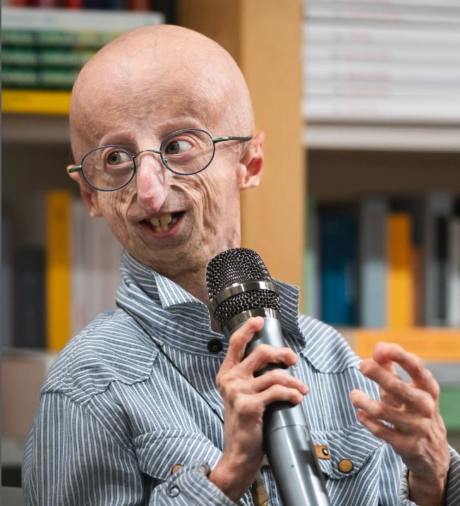 Progeria, quanto manca alla cura della malattia di Sammy Basso?